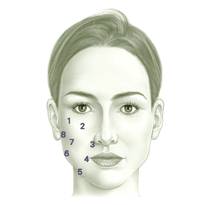 8 Point Face Lift - Somerset Cosmetic Clinic