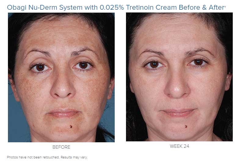 Obagi - Somerset Cosmetic Clinic